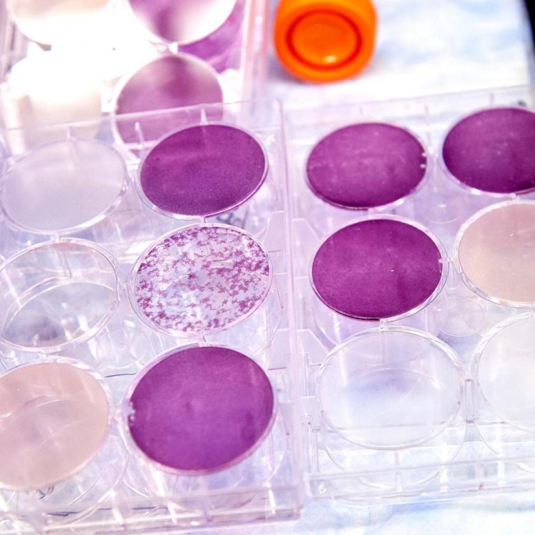 Alumni Benefits | NYU Langone Health