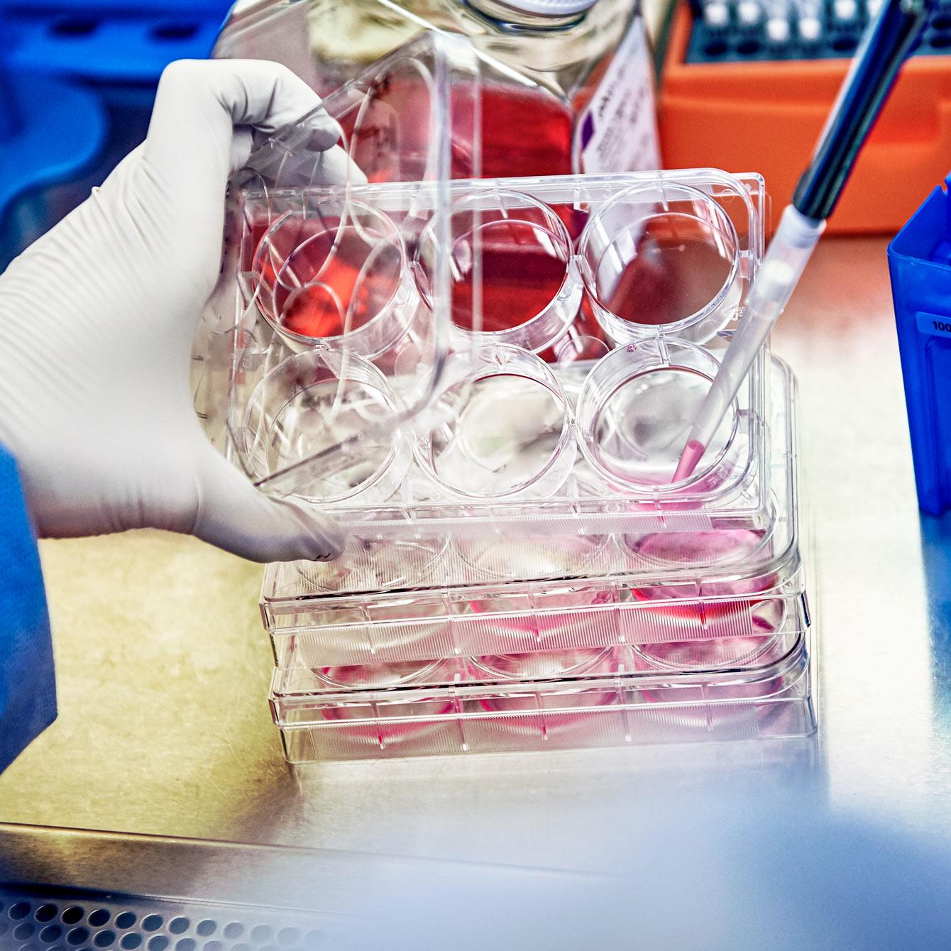 Judith & Stewart Colton Center for Autoimmunity | NYU Langone Health