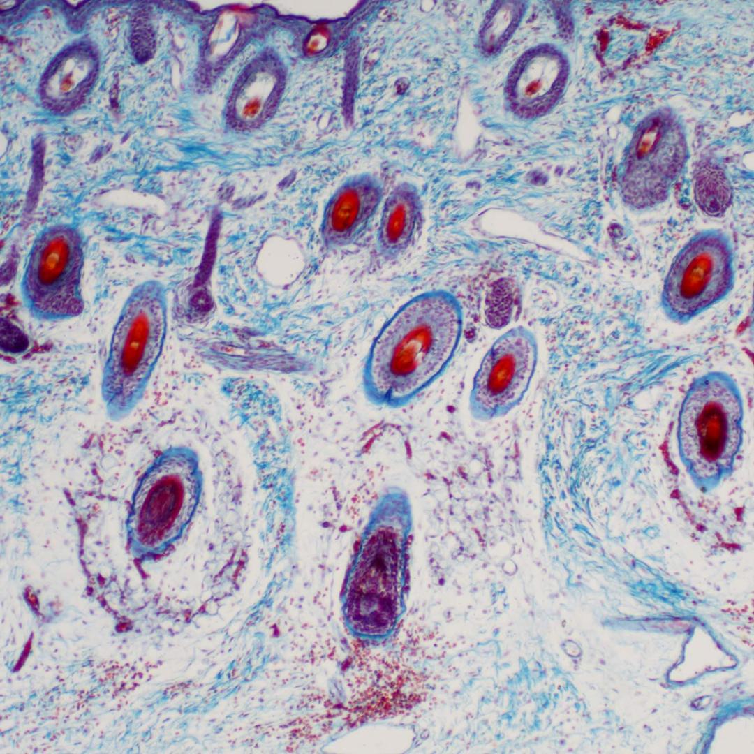 Department of Dermatology Education | NYU Langone Health