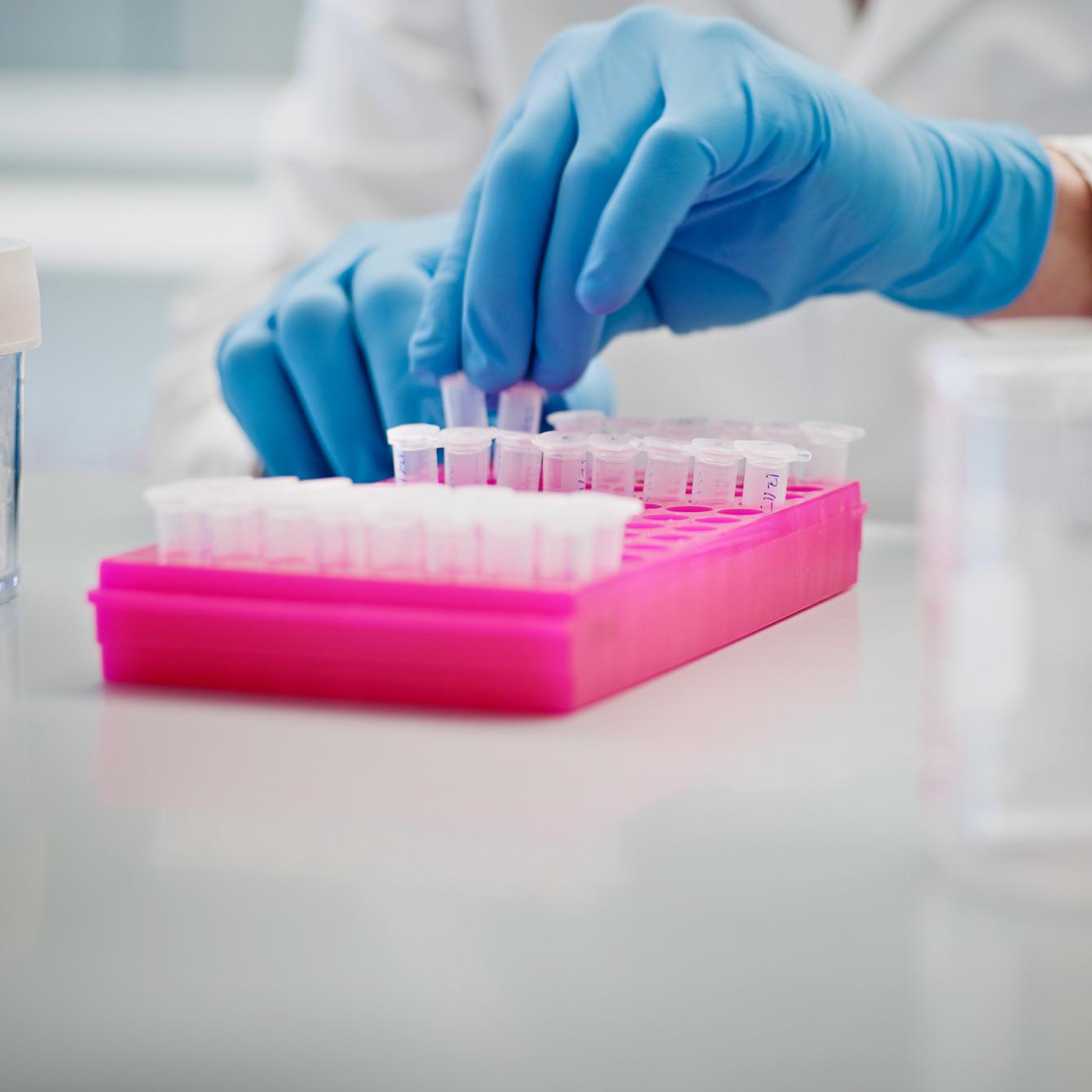 Department of Dermatology Research—Cutaneous Biology Program | NYU ...