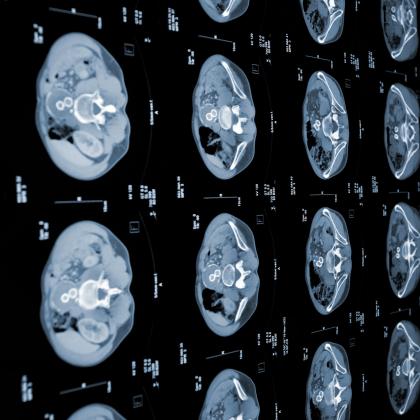 Division of Nephrology | NYU Langone Health