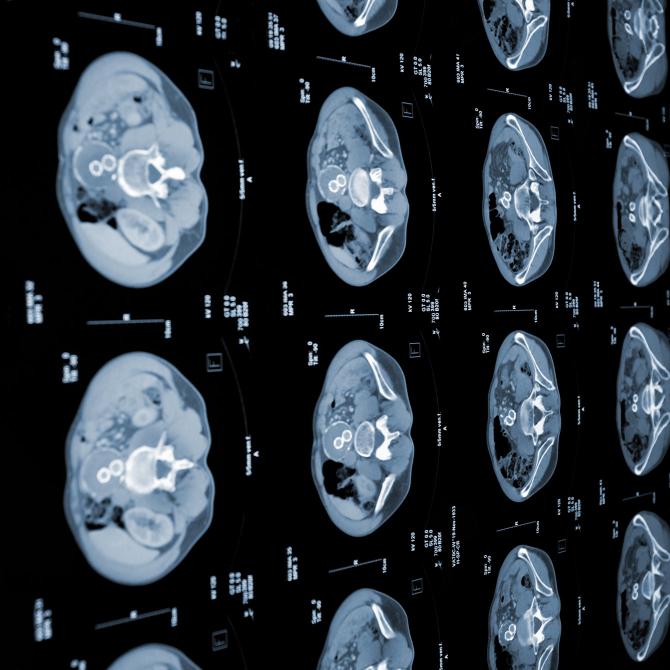 Division of Nephrology | NYU Langone Health