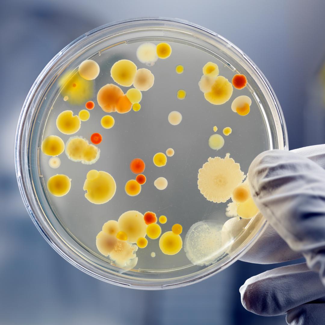 Department of Microbiology | NYU Langone Health