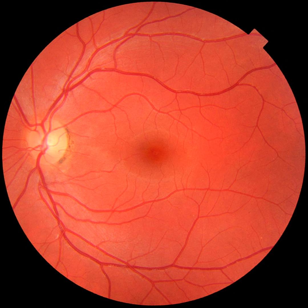 Department of Ophthalmology | NYU Langone Health