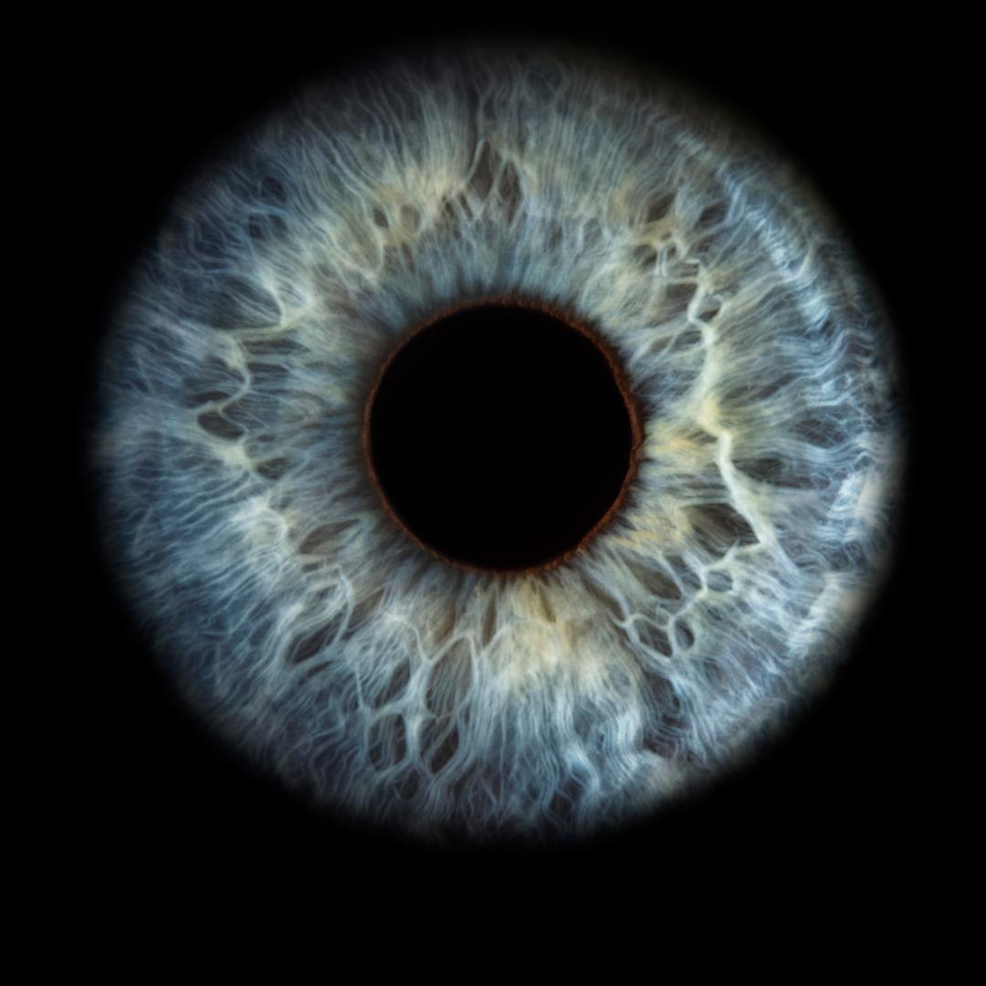 Zoster Eye Disease Study | NYU Langone Health