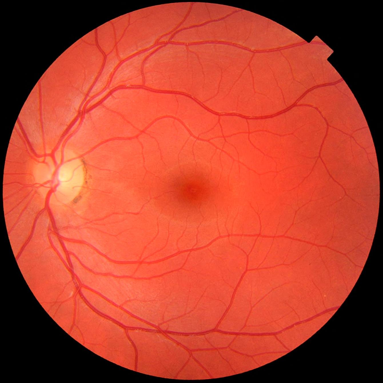 Department of Ophthalmology | NYU Langone Health