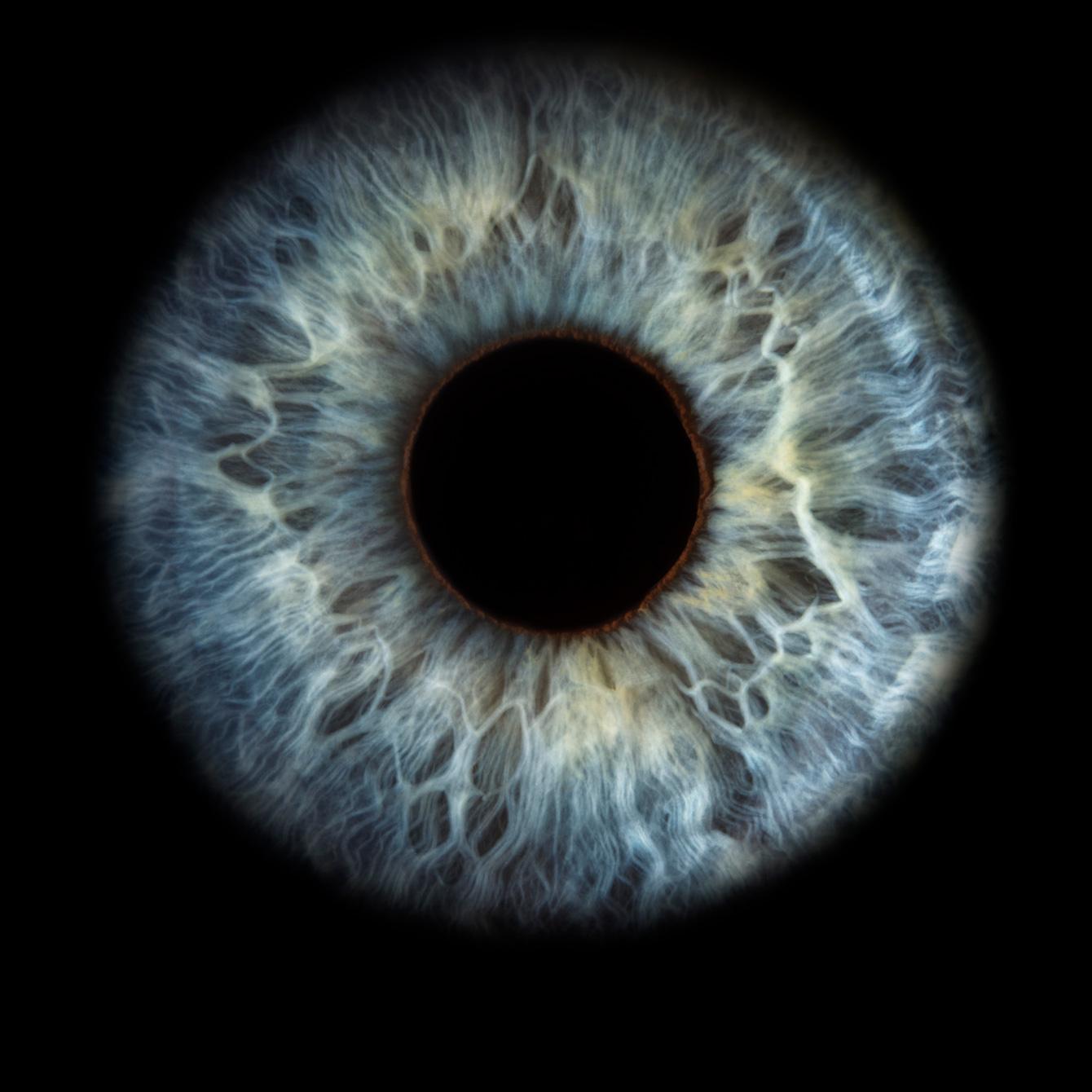 Zoster Eye Disease Study | NYU Langone Health