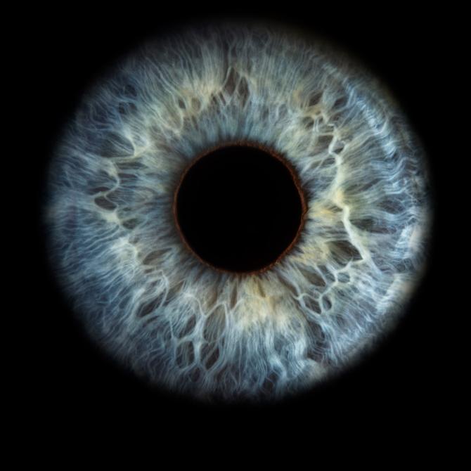 Zoster Eye Disease Study | NYU Langone Health