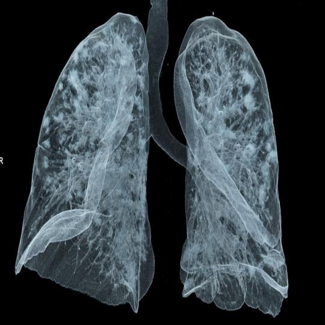 Department of Radiology Divisions | NYU Langone Health