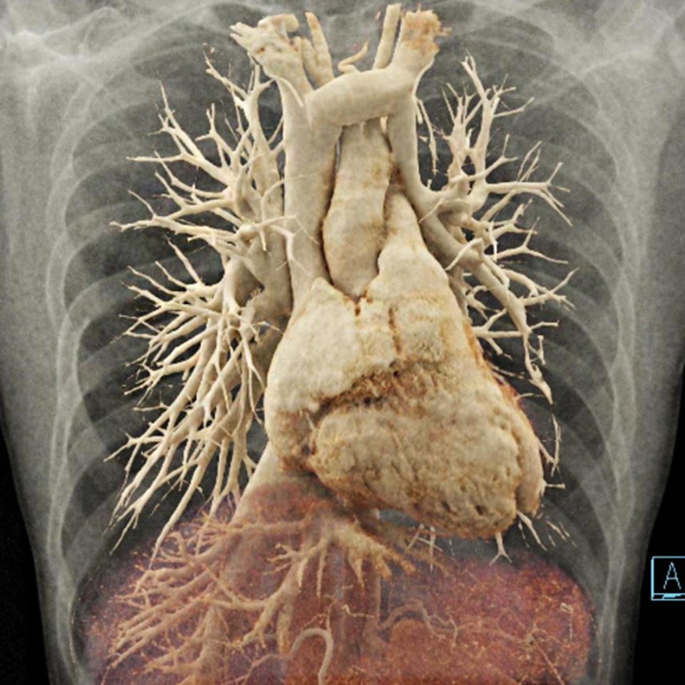 Radiology Fellowships | NYU Langone Health