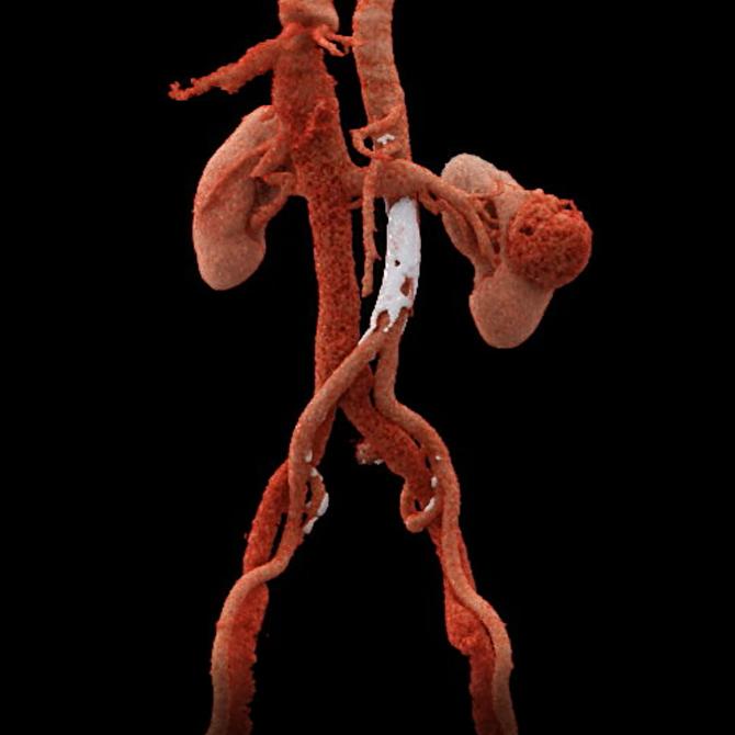 Department of Radiology Divisions | NYU Langone Health