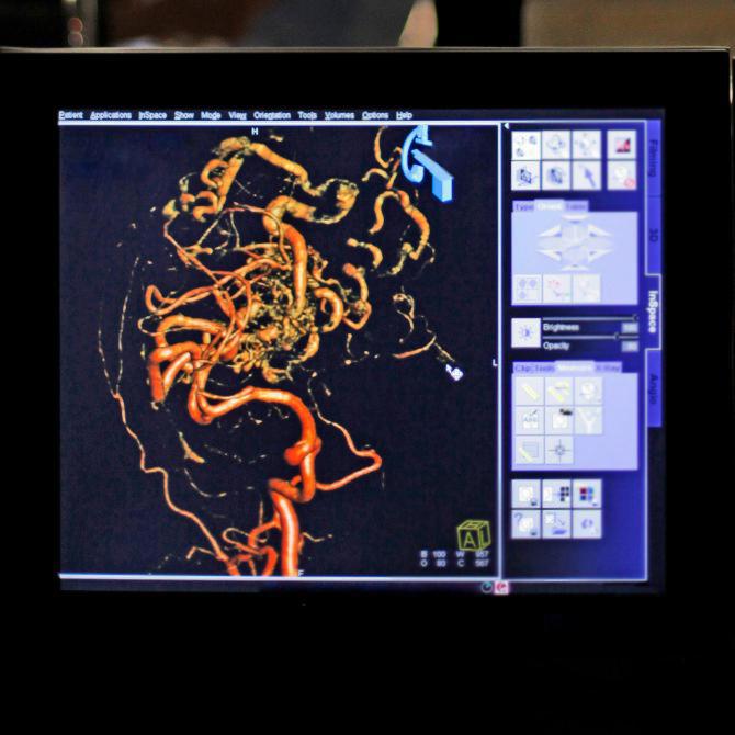 Department of Radiology Divisions | NYU Langone Health