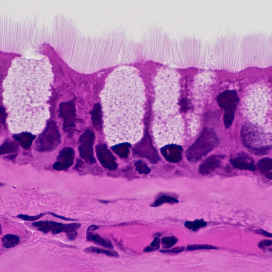 Research | NYU Langone Health