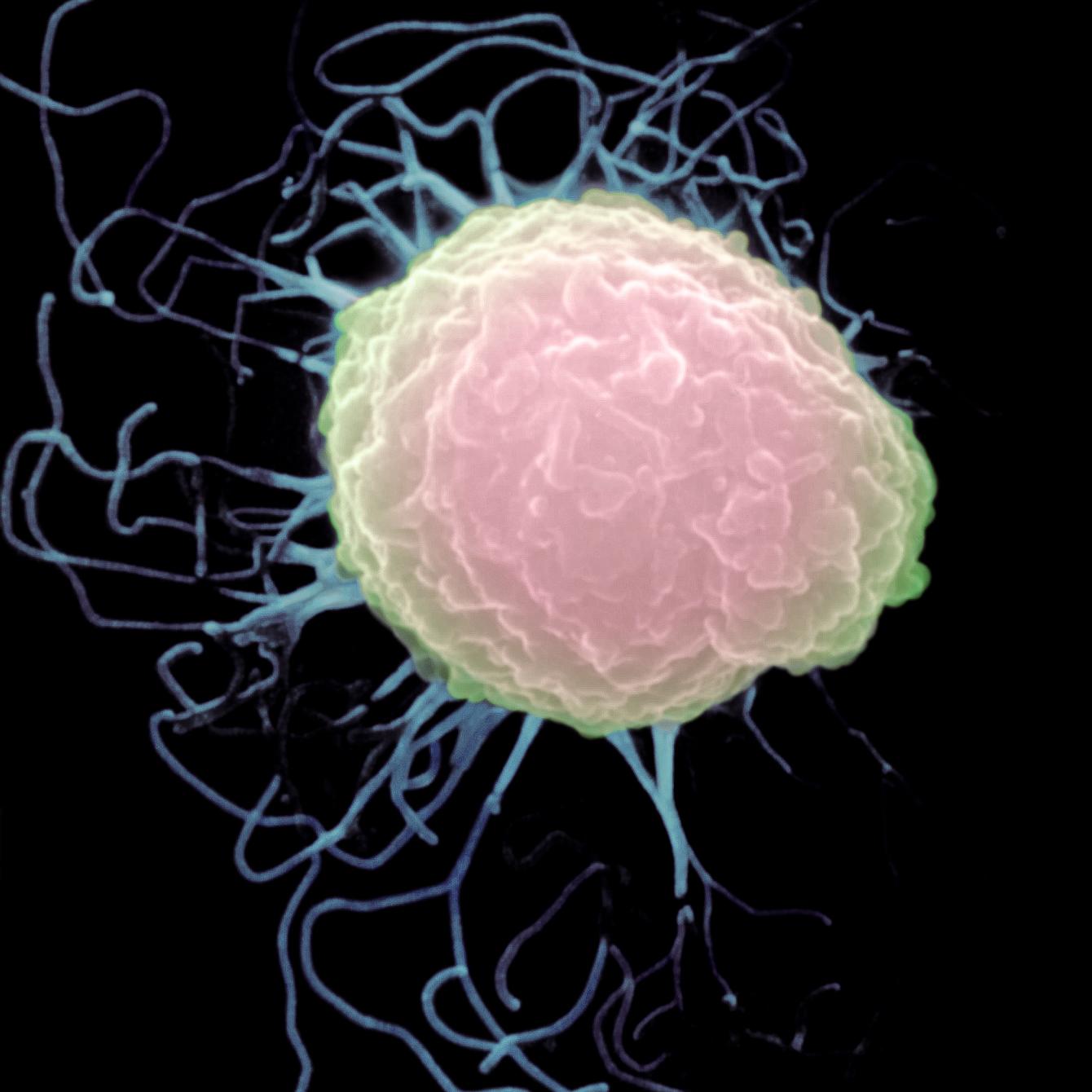 Research | NYU Langone Health