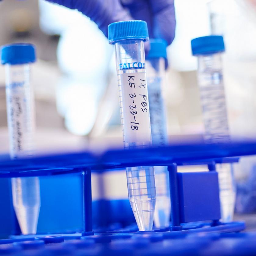 Research | NYU Langone Health